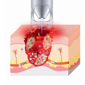 neoplas vet: jet cold plasma for veterinary medicine